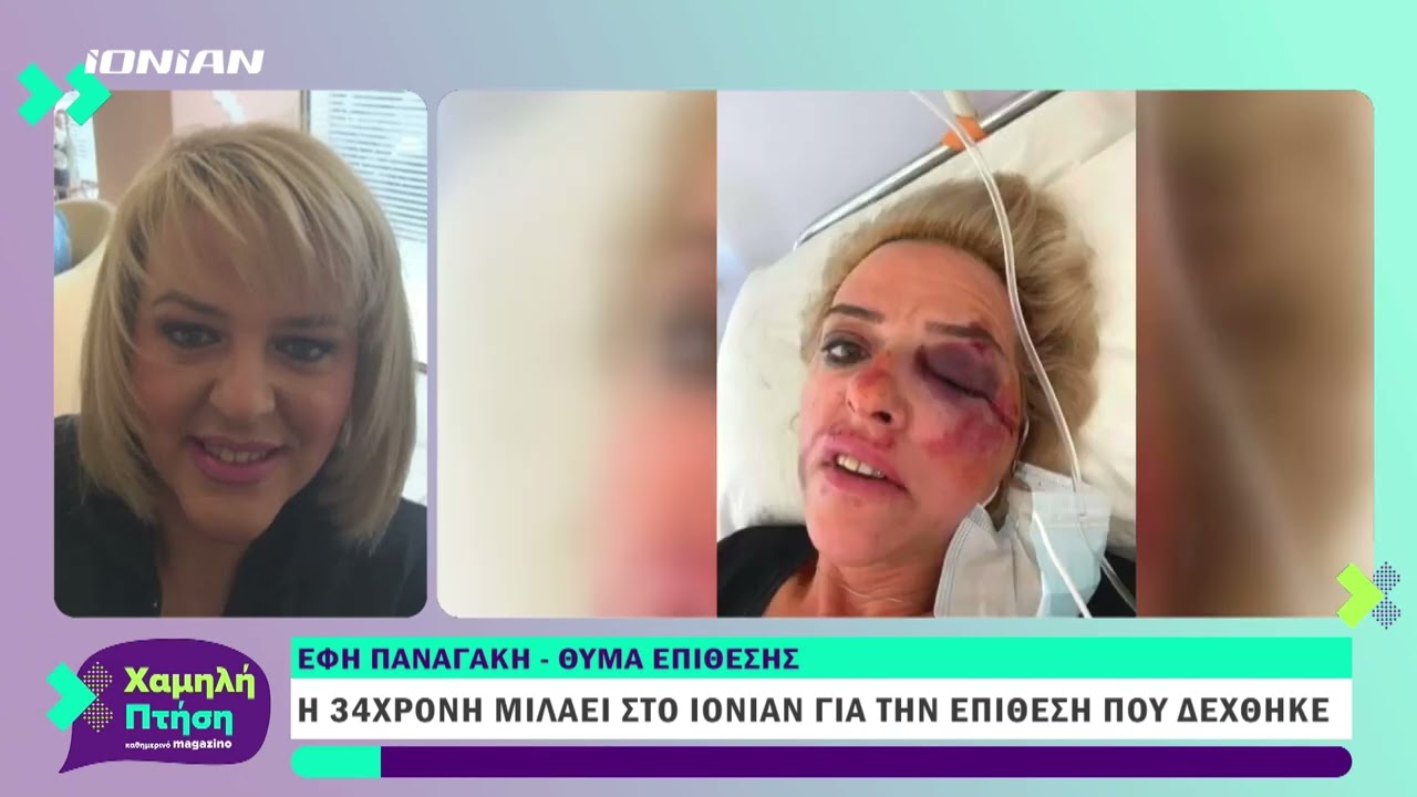 Καλαμάτα | 'Αγρια επίθεση αδέσποτων σε γυναίκα - Ionian TV